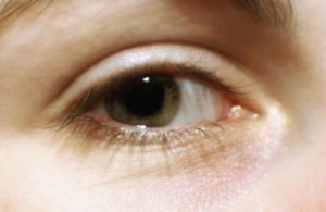 Eyelash Loss: Symptoms, Causes And Other Risk Factors - Home Remedies ...