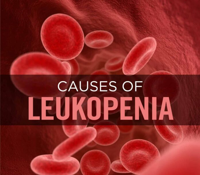 Leukopenia; Some 9 Causes, Symptoms & Risk Factors