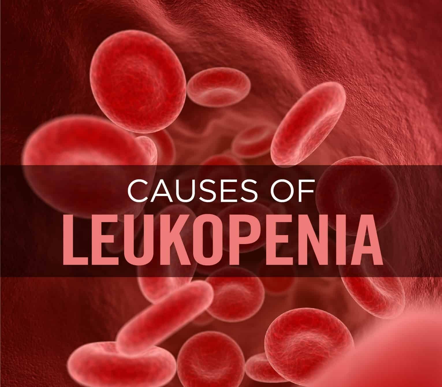 Leukopenia; Some 9 Causes, Symptoms & Risk Factors