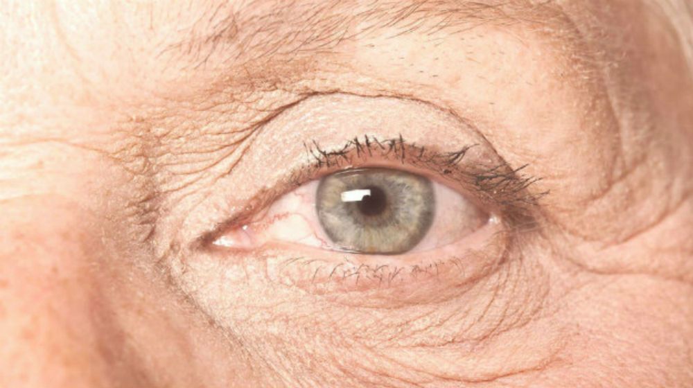 Macular Degeneration Types Signs Symptoms And Causes Macular Degeneration Types Signs Symptoms And Causes