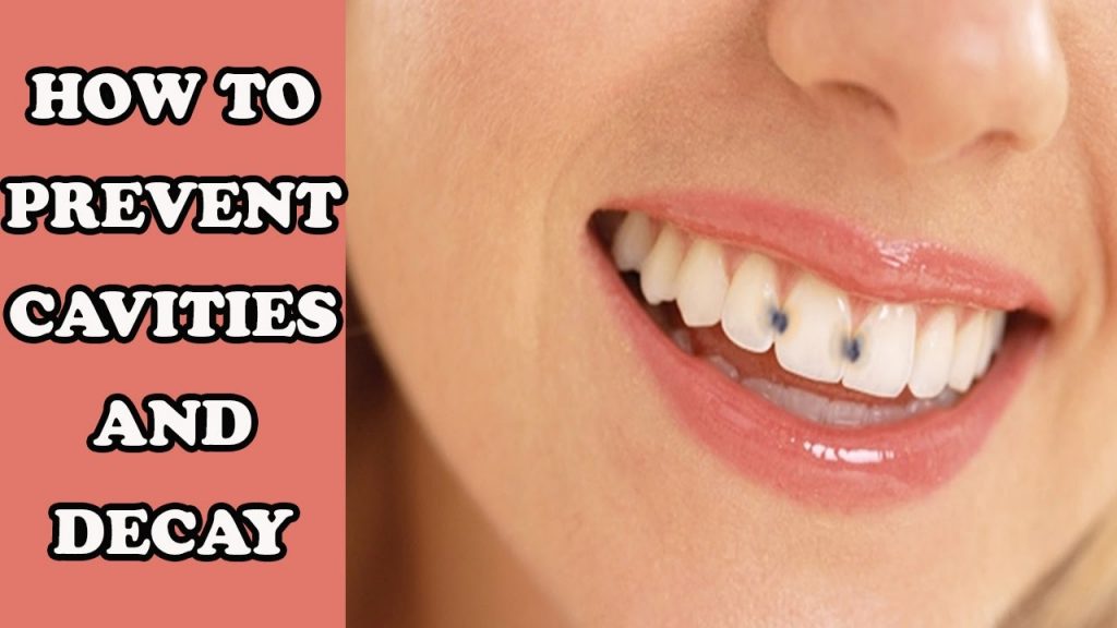 How To Prevent Tooth Cavities And Tooth Decay Naturally From Home