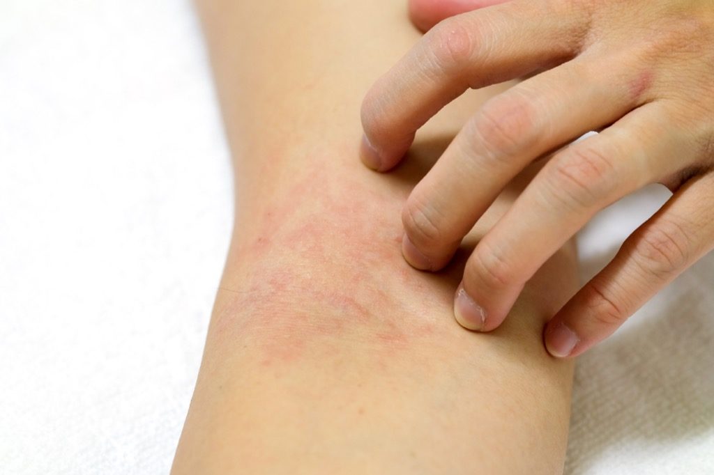 Skin Cancer Different Types Their Symptoms And Causes