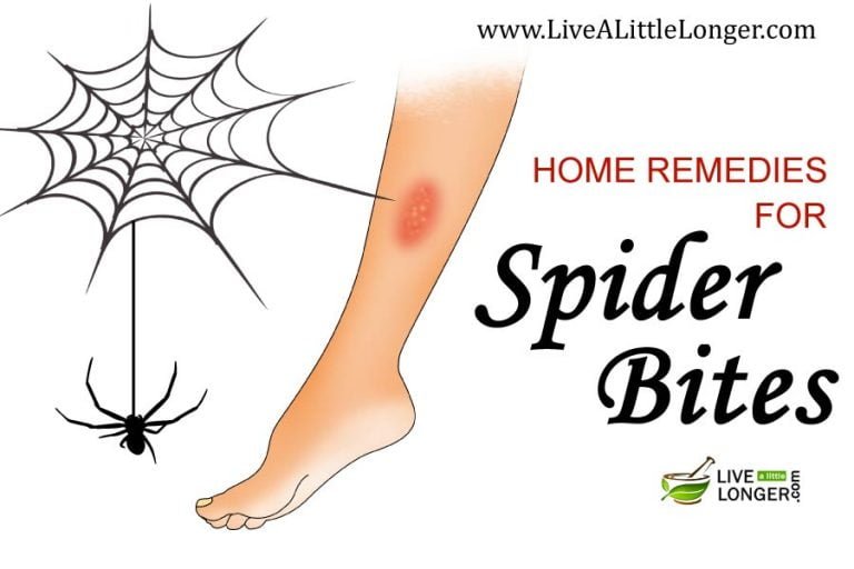 Natural Treatment For Spider Bites - Salt, Lemon And Potatoes