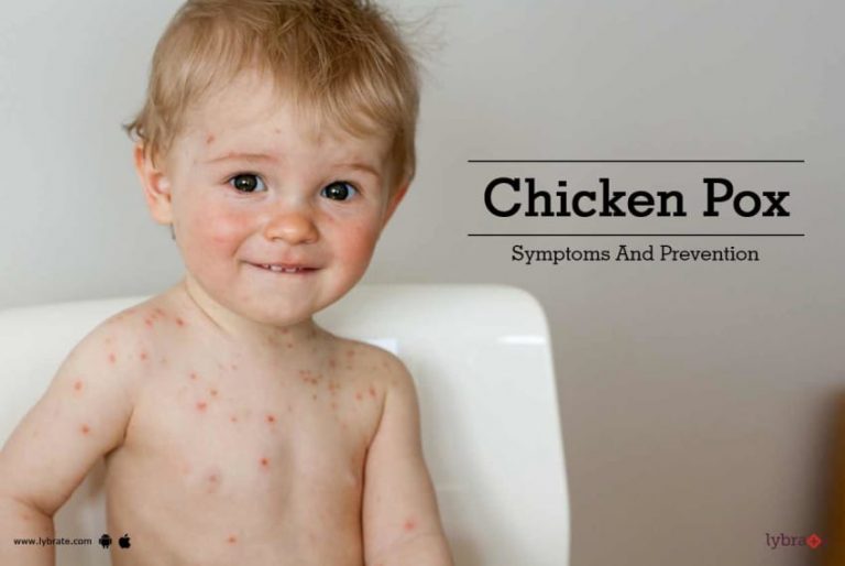 Signs And Symptoms Of Chickenpox Including Complications