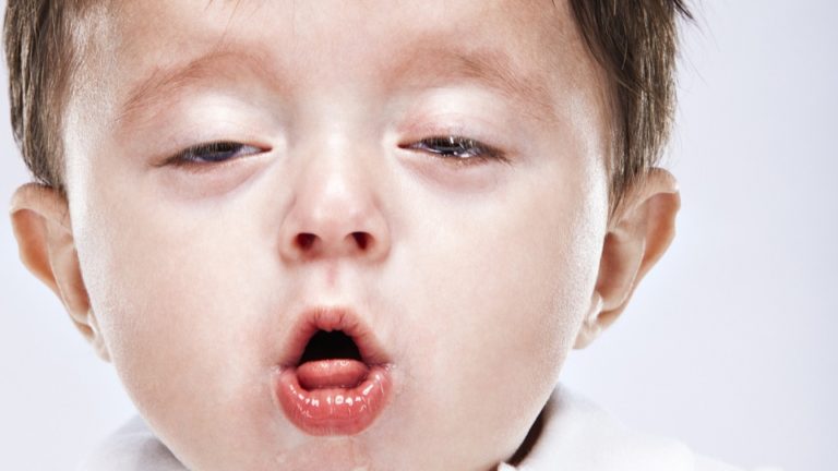 Whooping Cough Treatment With Honey, Ginger And Lemon